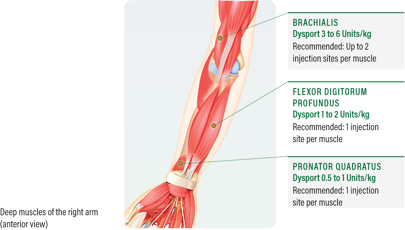 Dysport® Pediatric Spasticity Dosing & Administration Data