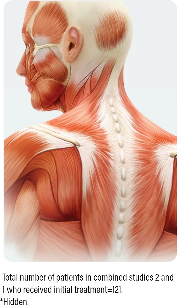 Dysport® Cervical Dystonia Dosing & Administration Data