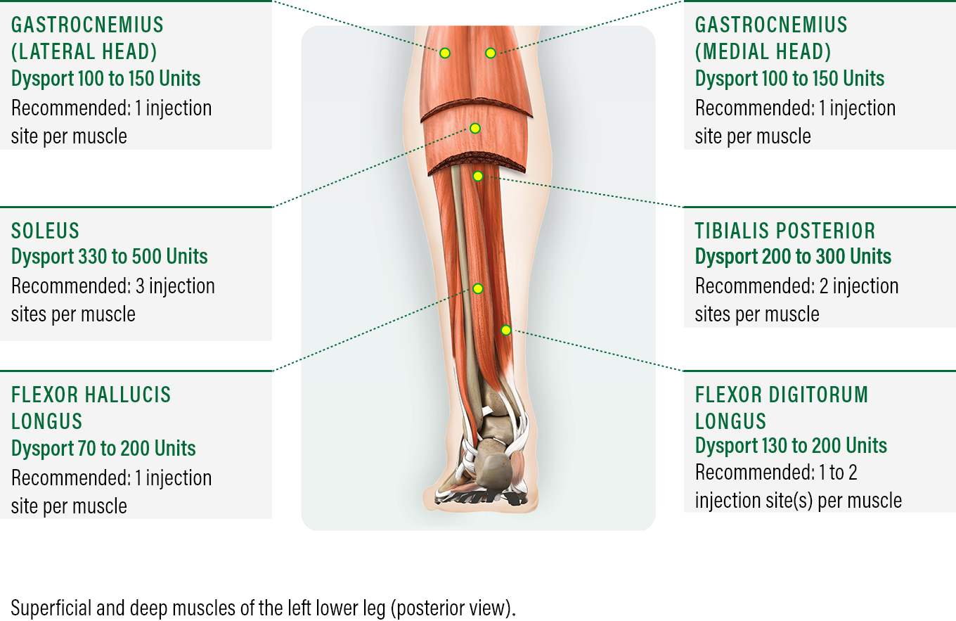 Get Dysport® Spasticity Dosing & Administration Data